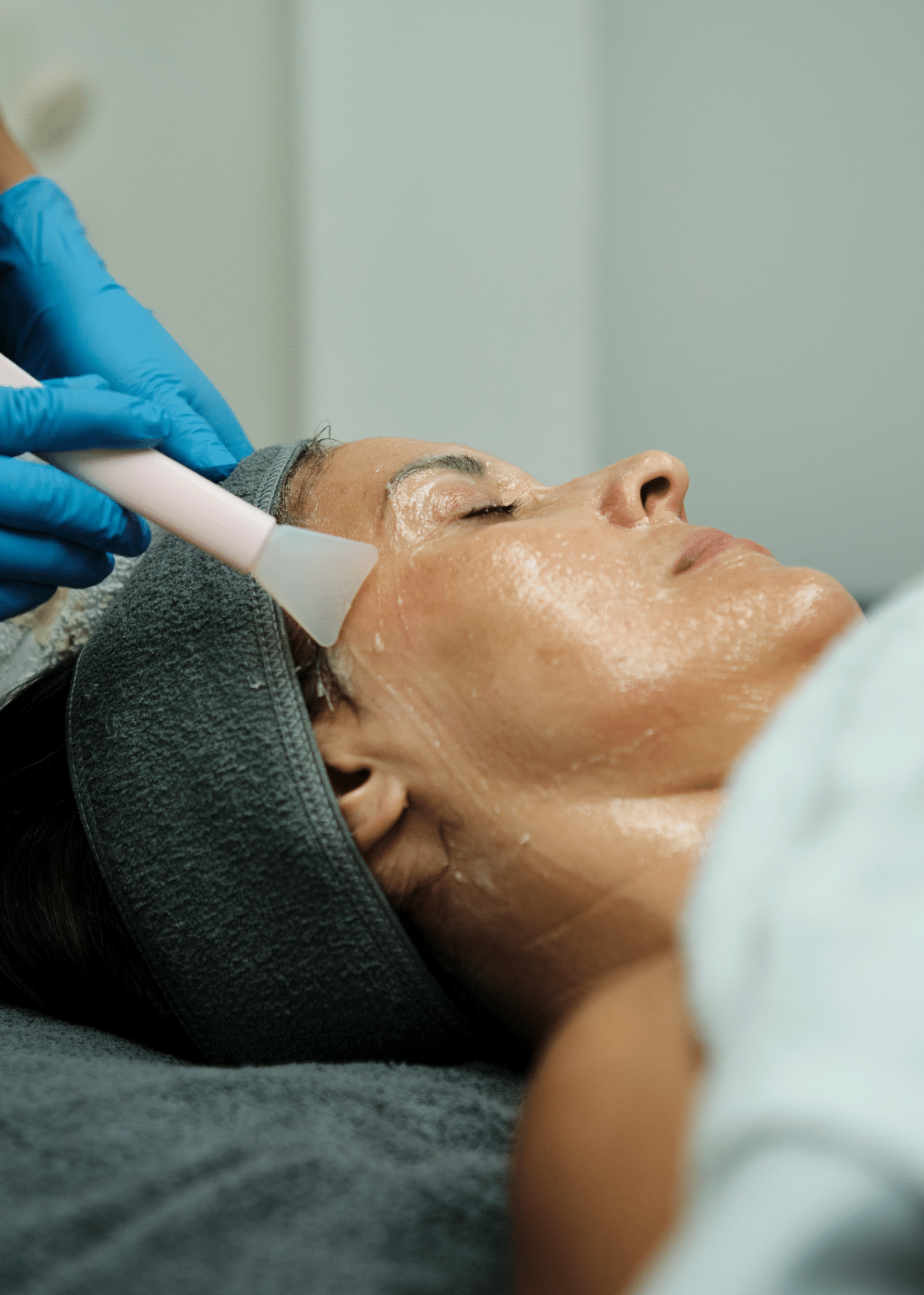 Chemical Peels | Valparaiso, IN | Fíka Spa
